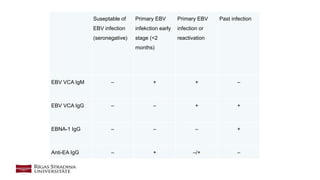 EBV connection to adenotonsillar hypetrophy | PPT