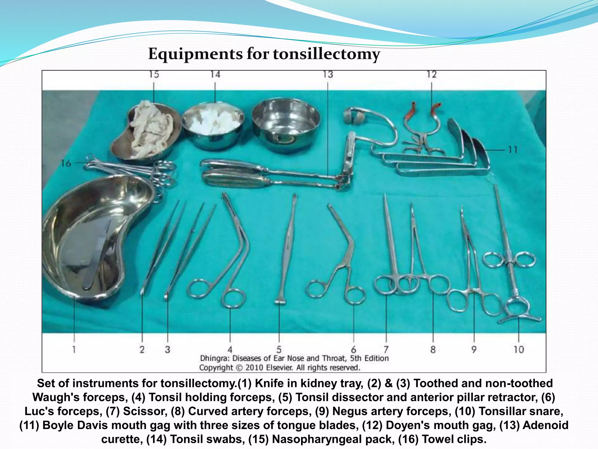 Tonsillectomy | PPTX