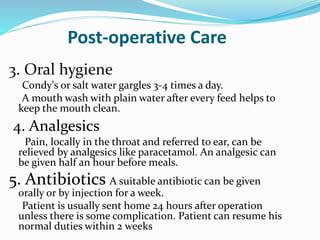 Tonsillectomy | PPTX