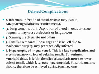 Tonsillectomy | PPTX