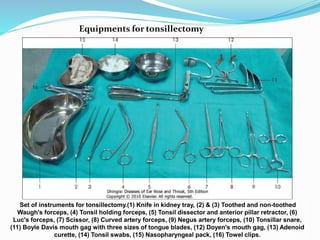 Tonsillectomy | PPTX