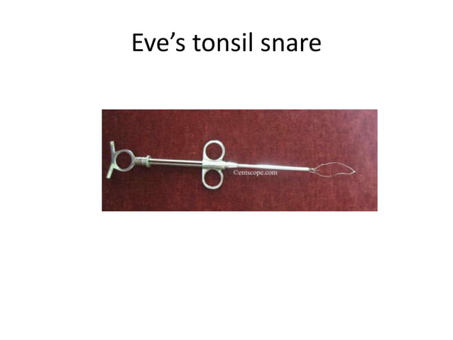 Tonsillectomy ENT for undergrad | PPTX