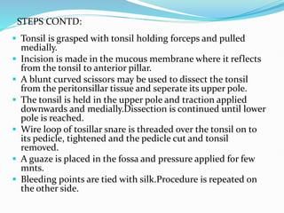 tonsillectomy ad ars h-161021153651.pdf
