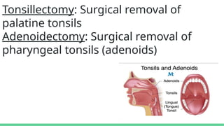 Tonsillectomy and Adenoidectomy - Procedure .pptx