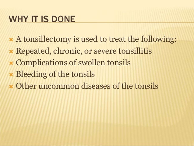 Tonsillectomy procedure | PPTX