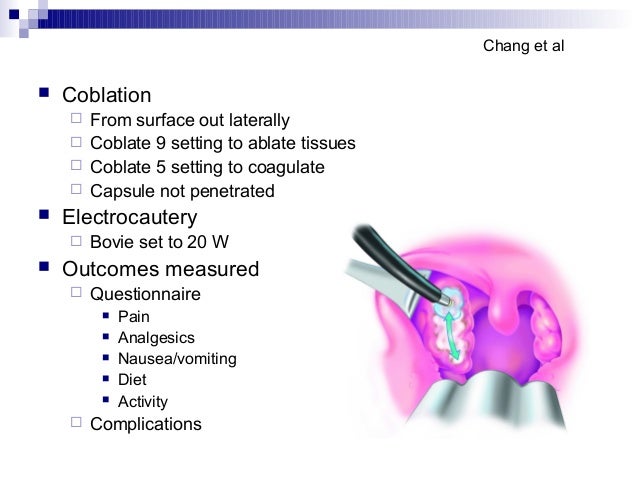 Tonsillectomy Slides 050427