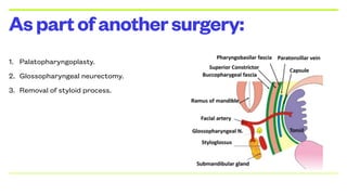 Tonsillectomy: Surgical Removal of Tonsils | PPT