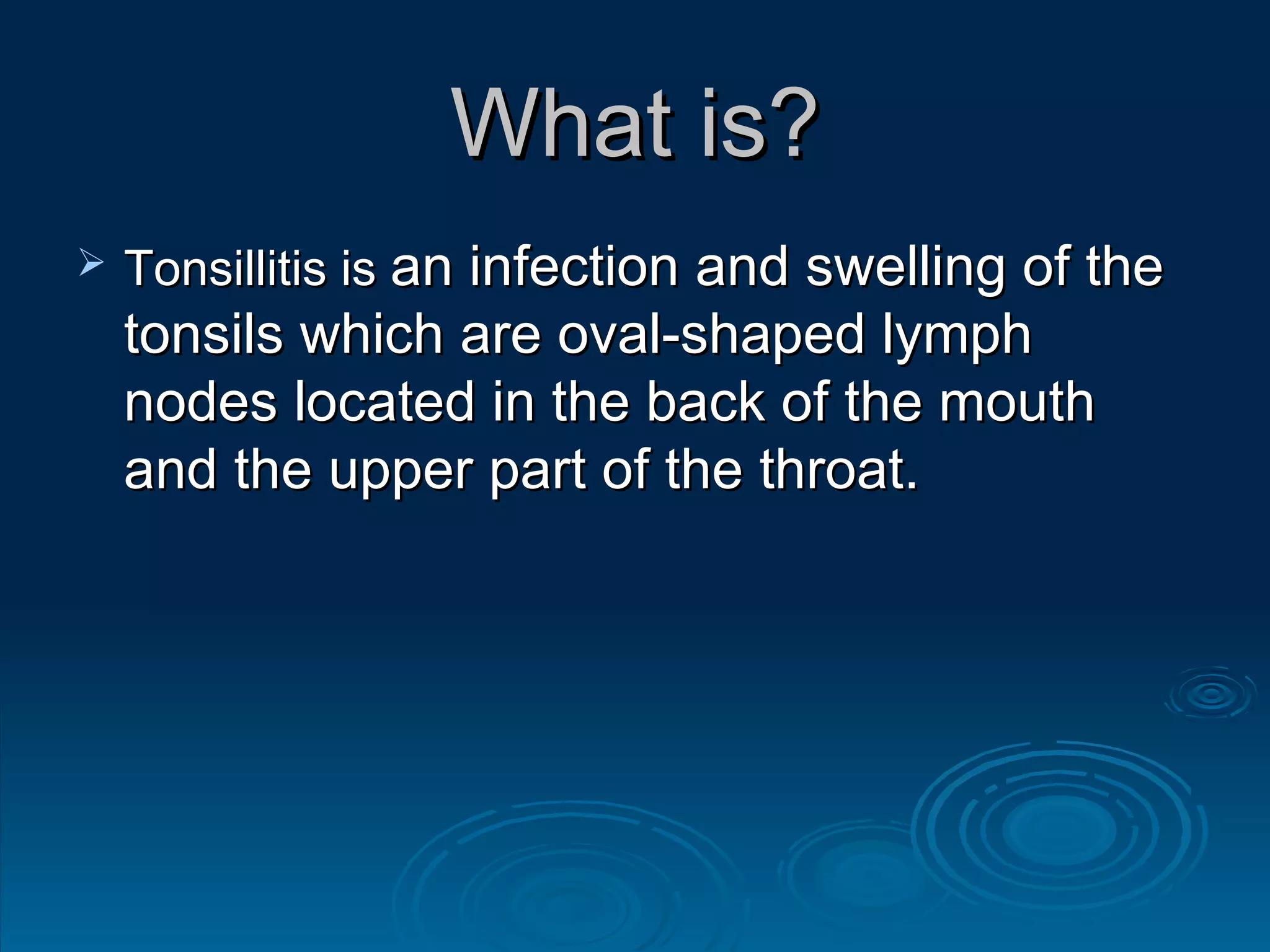Tonsillitis | PPT