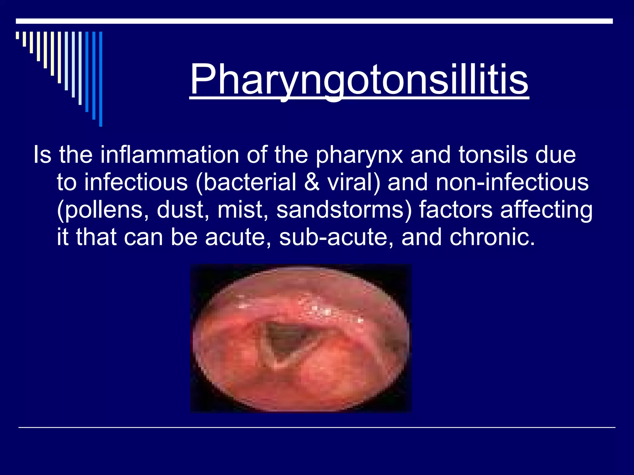 Tonsillitis | PPT
