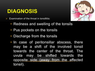 Tonsillitis | PPTX