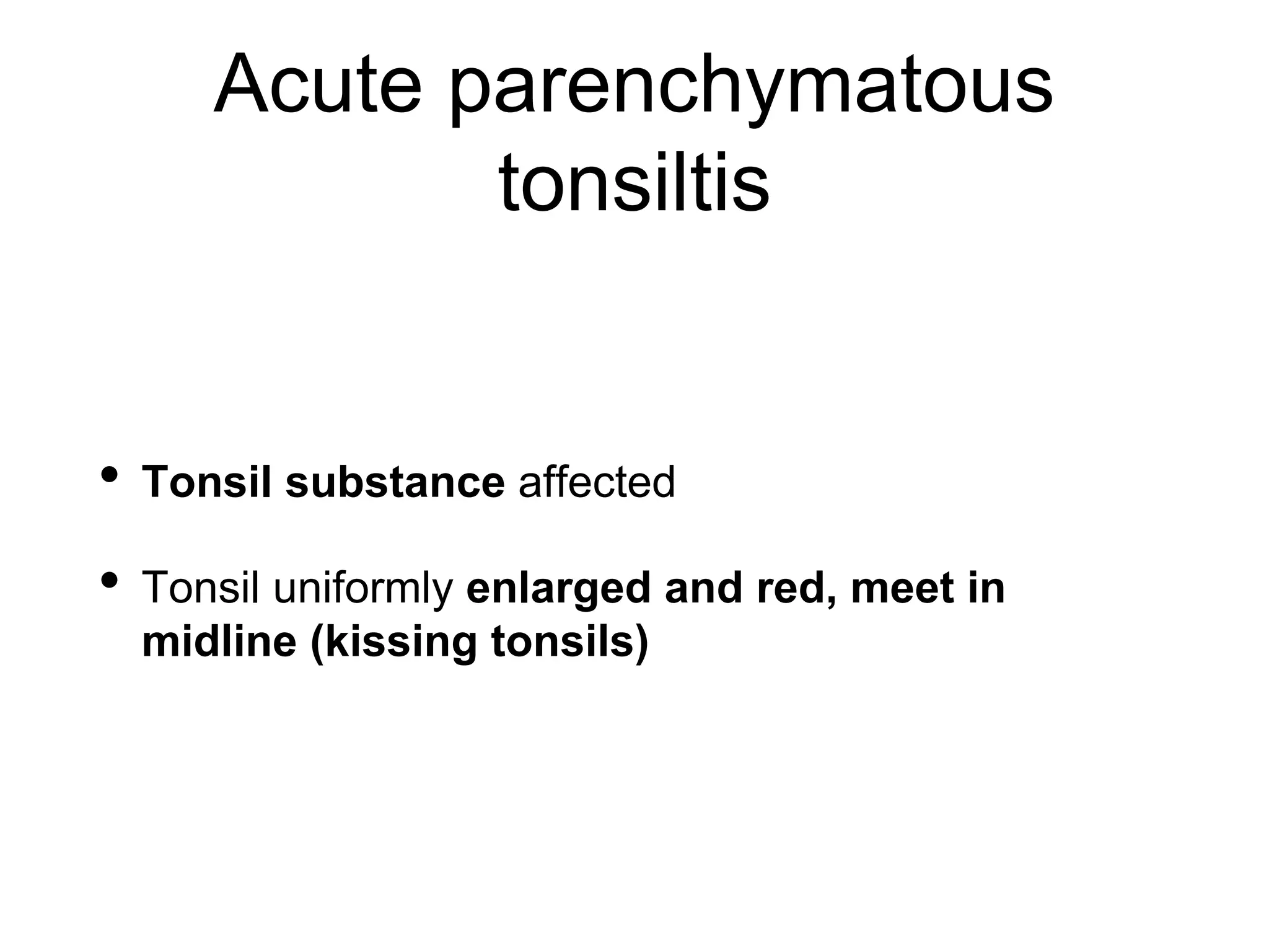 Tonsillitis | PPT