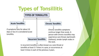 tonsillitis.pptx