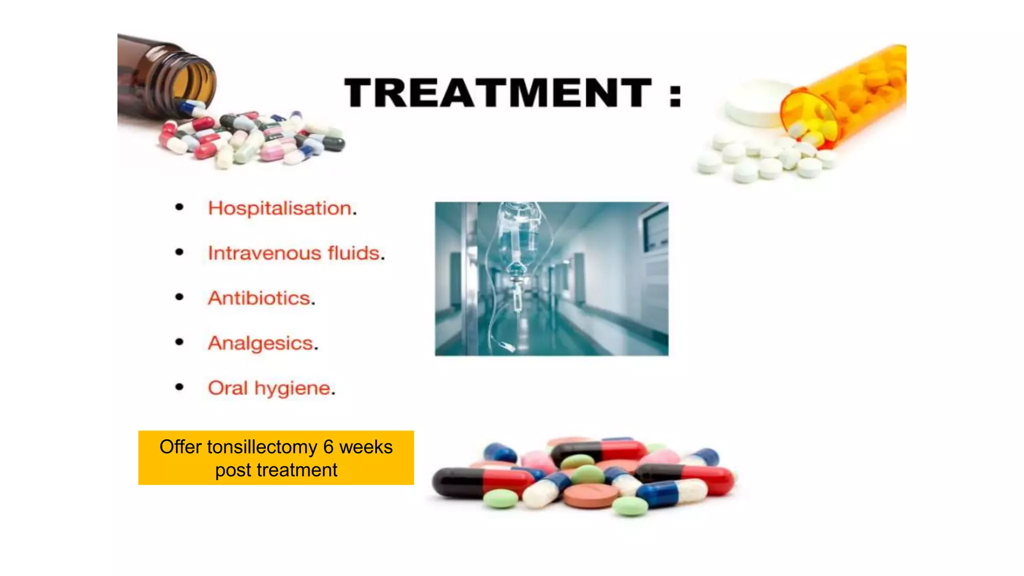 Tonsillitis Pptx Ear Nose And Throat Conditions Diseases And Conditions