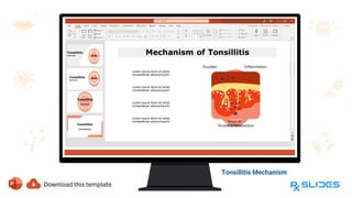 Tonsillitis | PDF