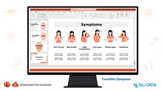 Tonsillitis | PDF