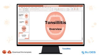 Tonsillitis | PDF