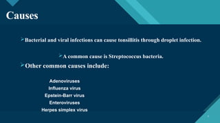 Tonsillitis tonsillitis tonsillitis tonsillitis tonsillitis tonsillitis ...