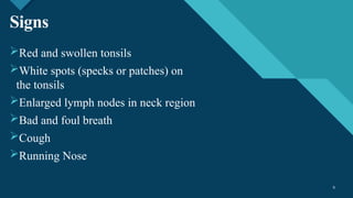 Tonsillitis tonsillitis tonsillitis tonsillitis tonsillitis tonsillitis ...