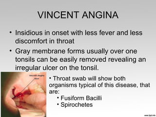 Tonsillitis case | PPT