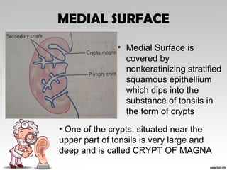 Tonsillitis case | PPT