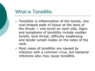 Tonsillitis-ppt.pptx