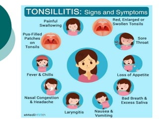 Tonsillitis-ppt.pptx