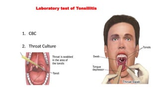 Tonsillitis guyhhfhjhgfhhhgggyjjhghjhhggh | PPT | Free Download