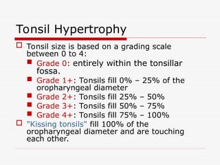 Tonsillitis by dr Adel Adwan ptt for all | PPT | Ear, Nose and Throat ...
