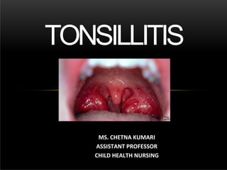 tonsillitis .pptx | Ear, Nose and Throat Conditions | Diseases and Conditions