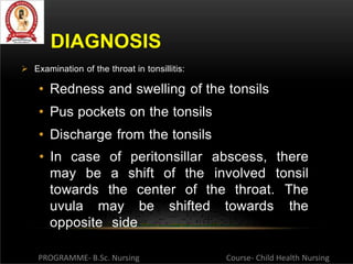 tonsillitis .pptx