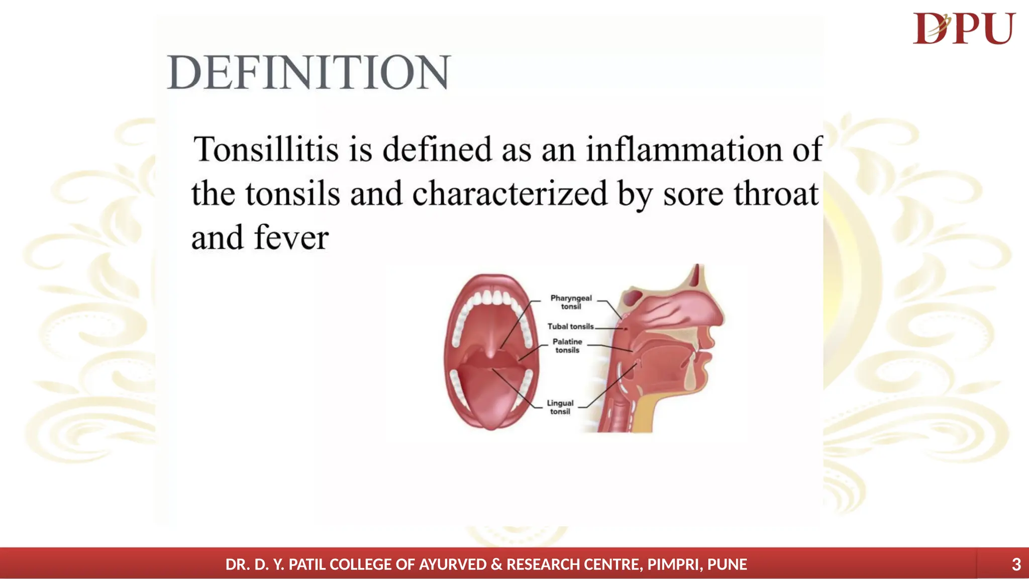 tonsillitis ppt.6456464312313131321351431.rfkewofofpptx | PPTX
