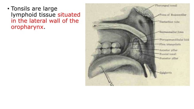 Tonsillitis, quinsy and adenoiditis | PPTX | Ear, Nose and Throat ...