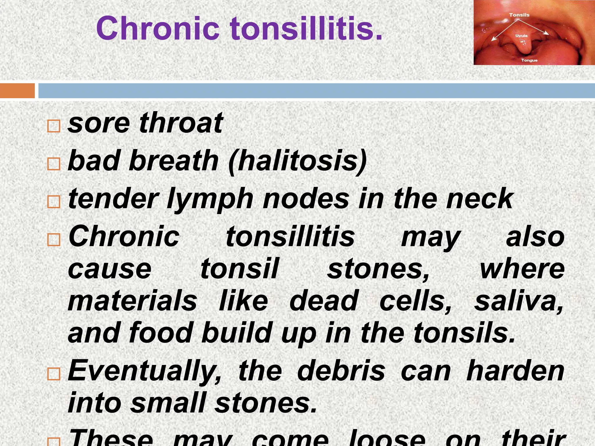 Nursing management of the patient with Tonsillitis PPT | PPTX