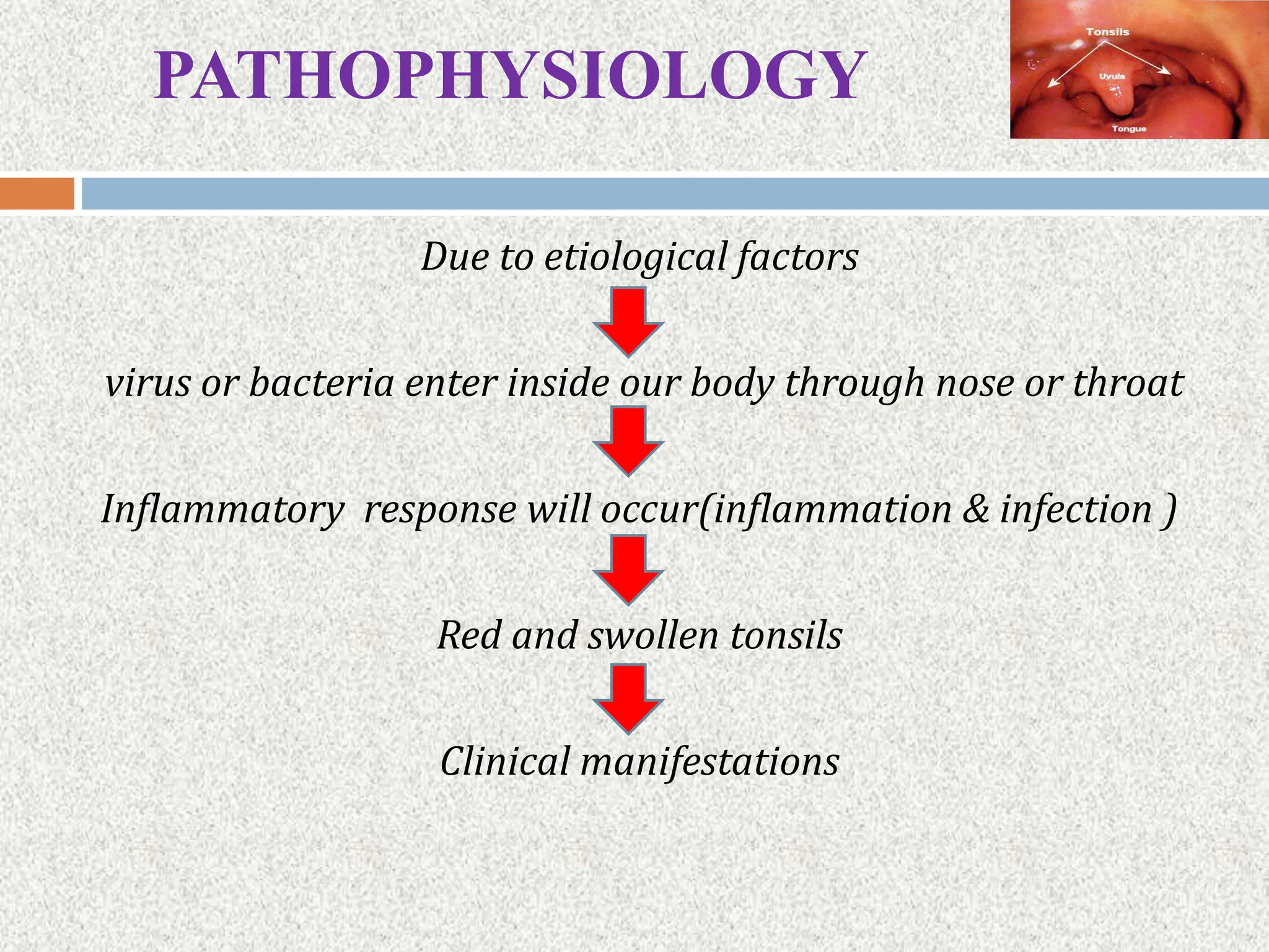 Nursing management of the patient with Tonsillitis PPT | PPTX