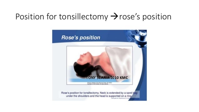 Tonsils ENT REVISION TOPIC