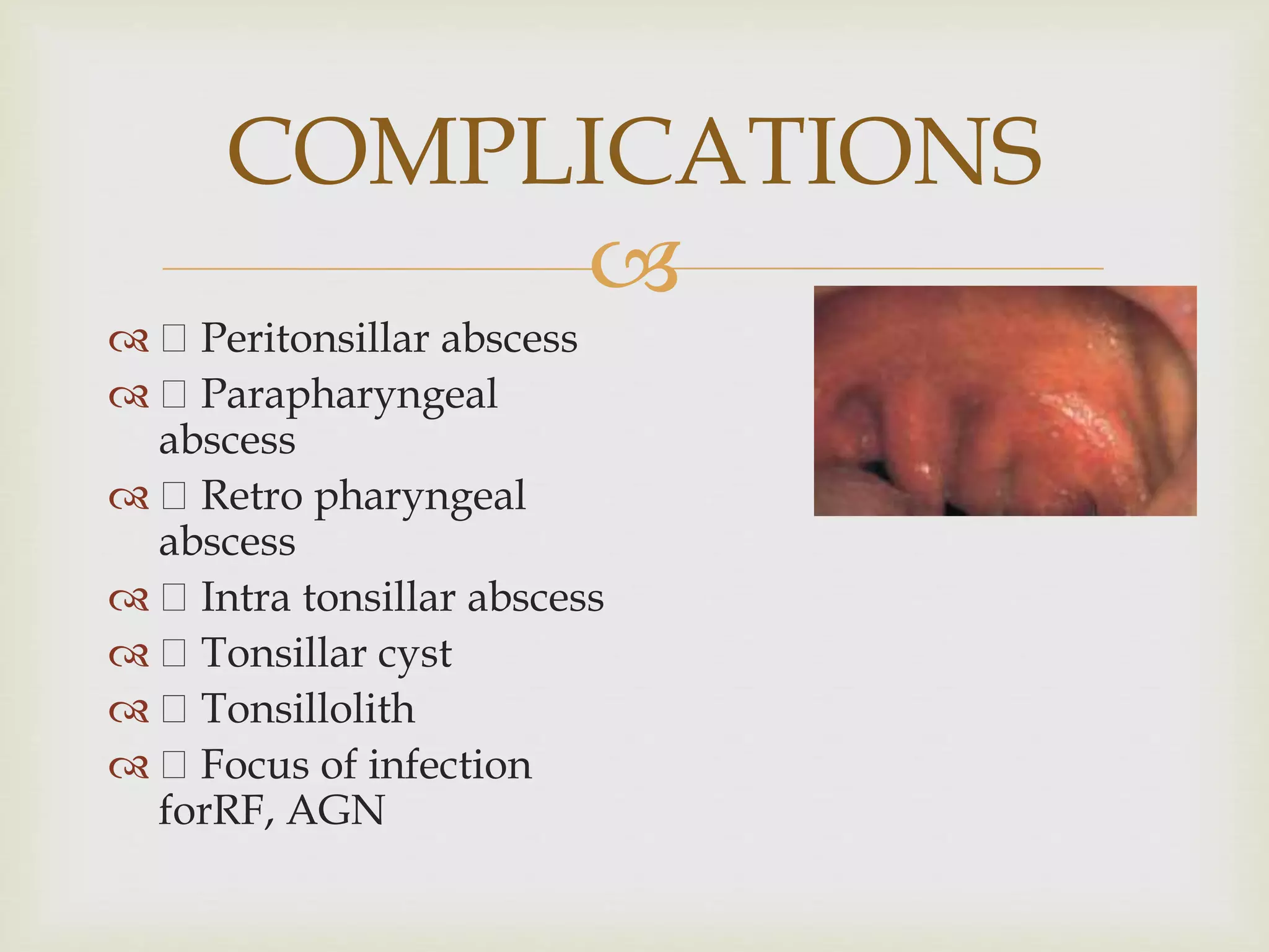 Tonsils ppt | PPTX