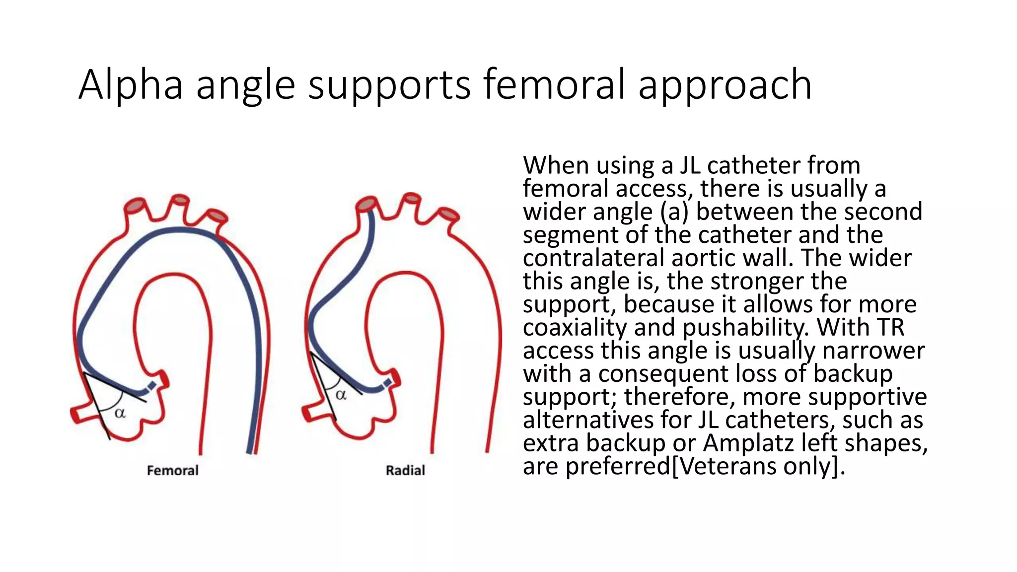Tools for transradial approach | PPTX