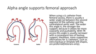 Tools for transradial approach | PPTX