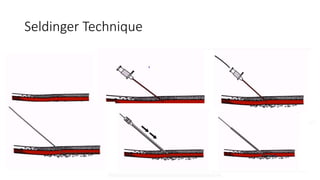 Tools in interventional radiology | PPTX