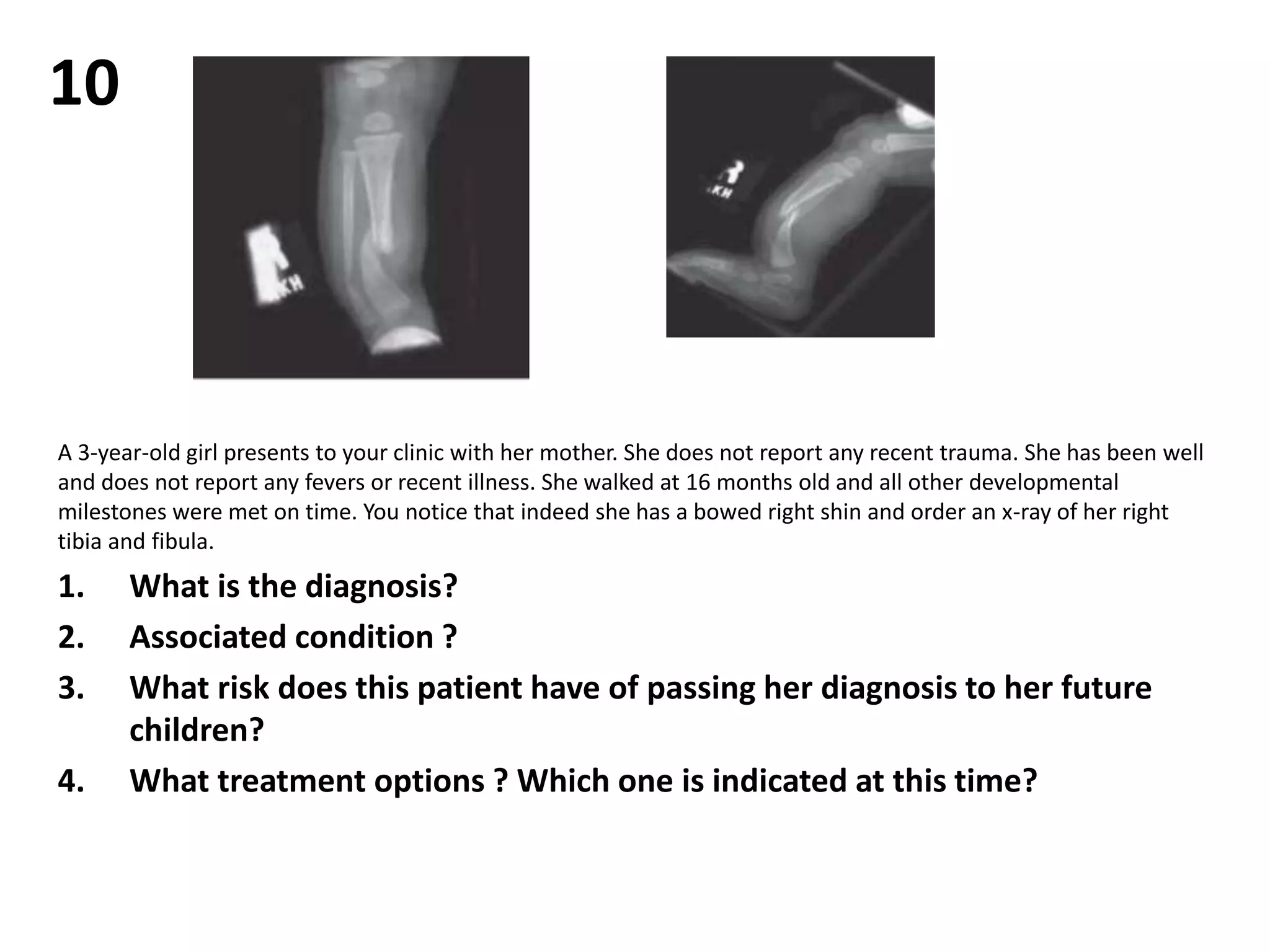 Osce pediatric case 2019 | PPTX