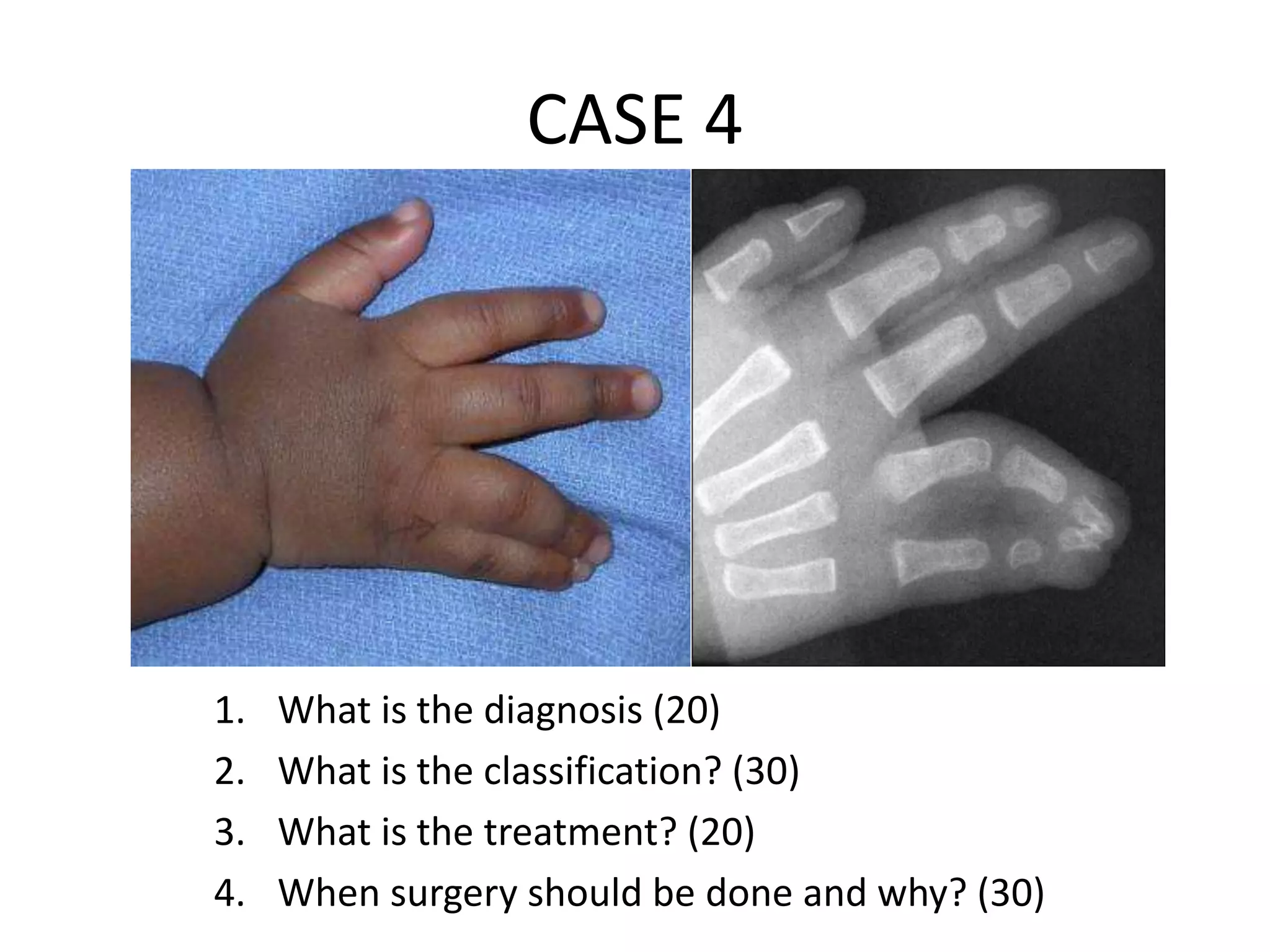 Osce pediatric case 2019 | PPTX