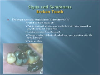 Tooth Injuries | PPT