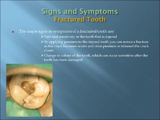 Tooth Injuries | PPT