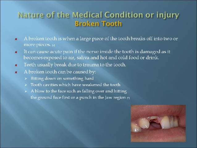 Tooth Injuries | PPT