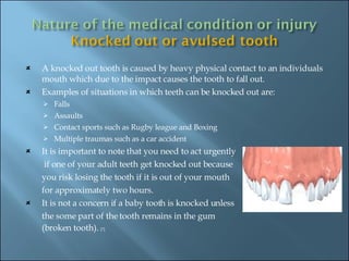 Tooth Injuries | PPT
