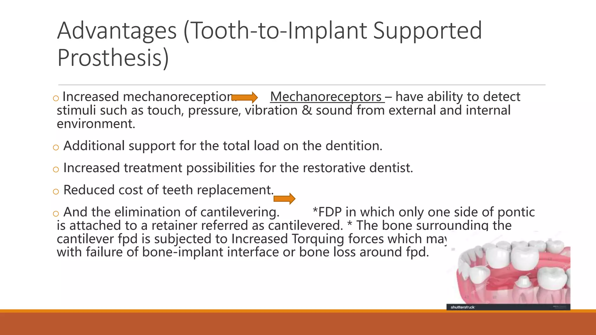 Tooth-to-Implant Supported Fixed Partial Dentures- A Comprehensive ...