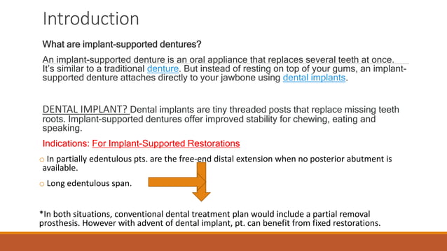 Tooth-to-Implant Supported Fixed Partial Dentures- A Comprehensive ...