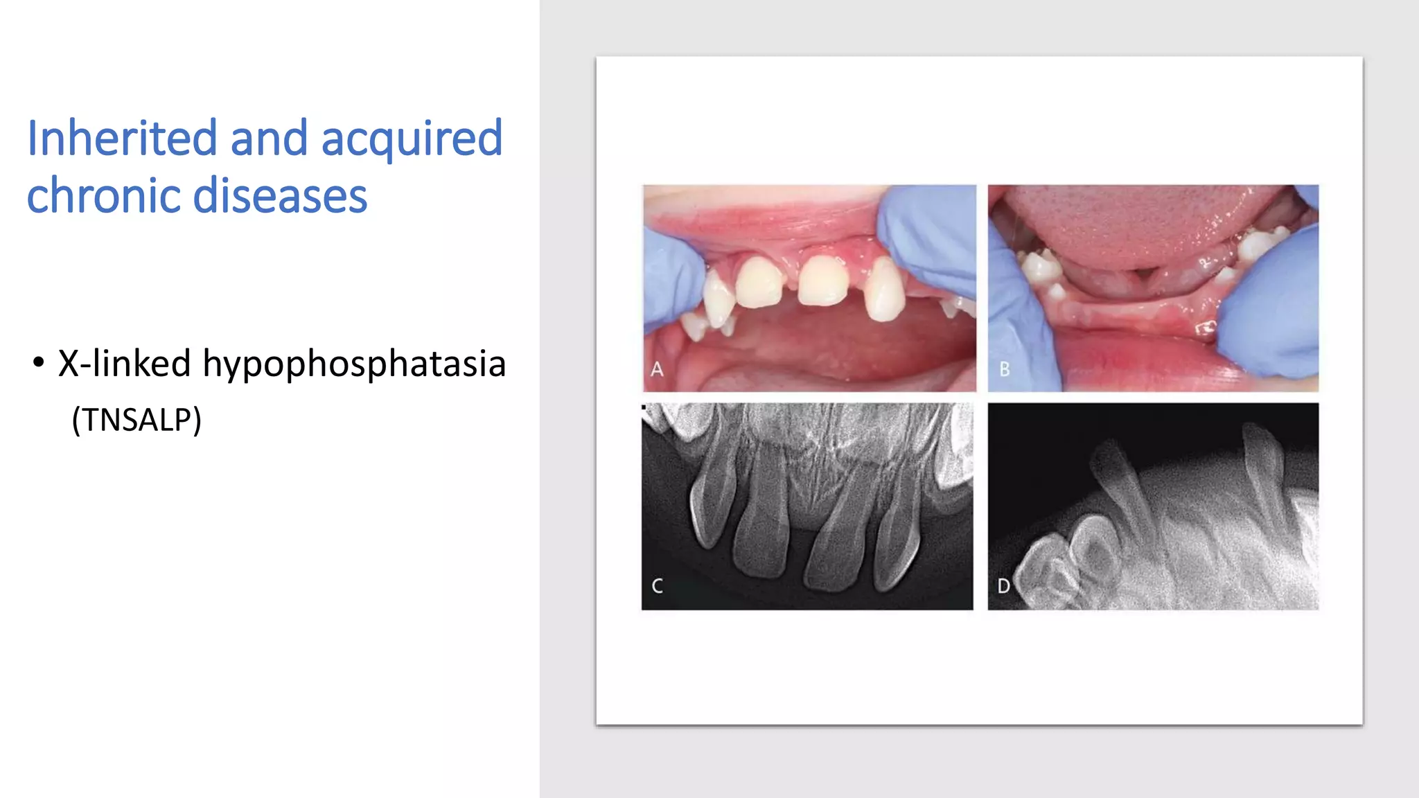 Tooth abnormality in systemic disease (Doctor Faris Alabeedi MSc ...