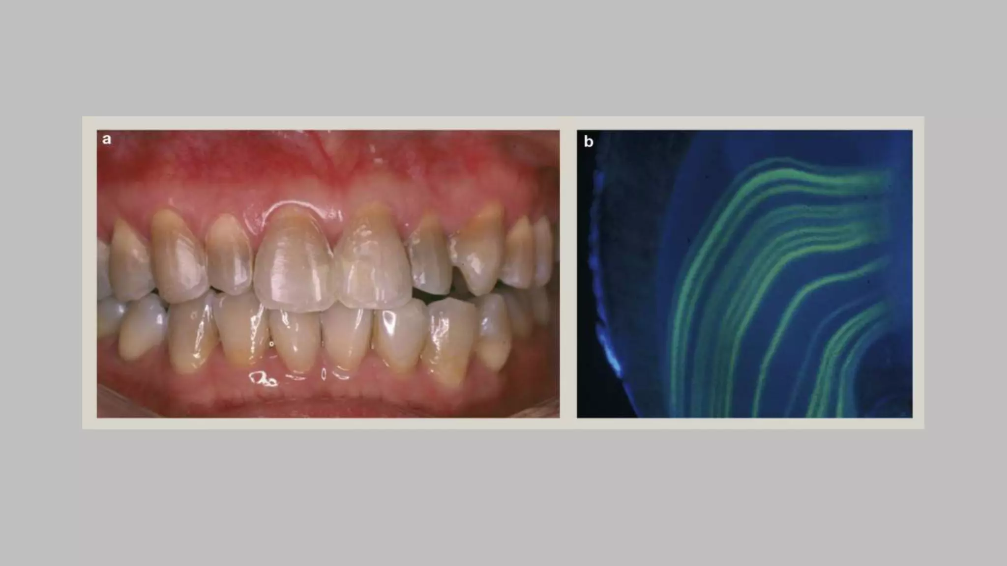 Tooth abnormality in systemic disease (Doctor Faris Alabeedi MSc ...