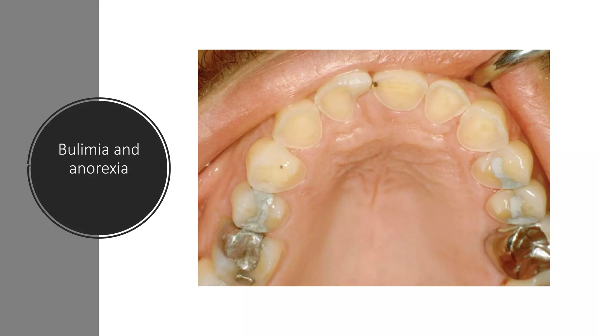 Tooth abnormality in systemic disease (Doctor Faris Alabeedi MSc ...